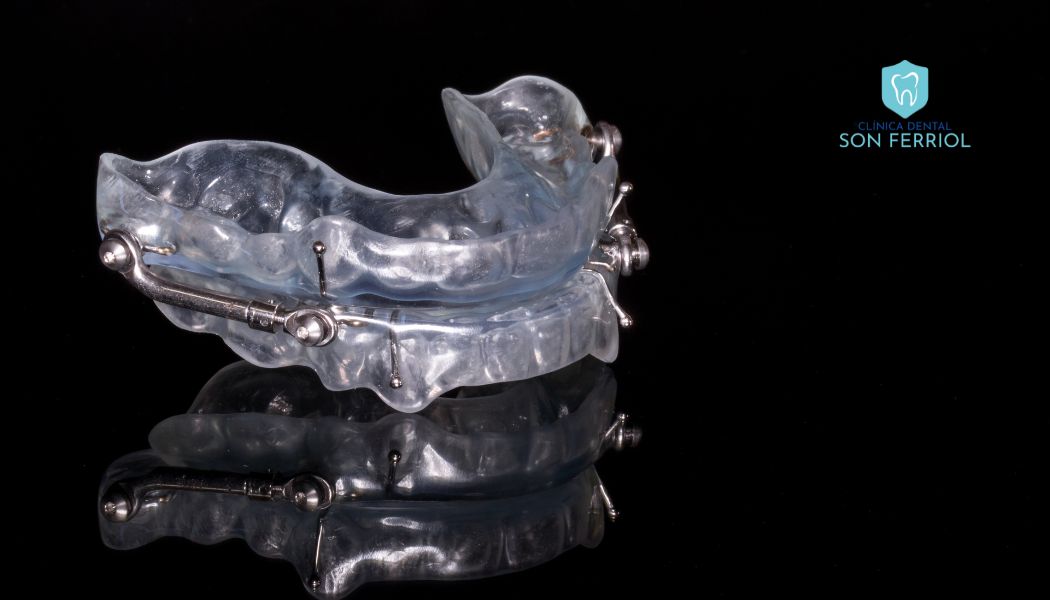 El papel de la odontología en el diagnóstico de trastornos del sueño